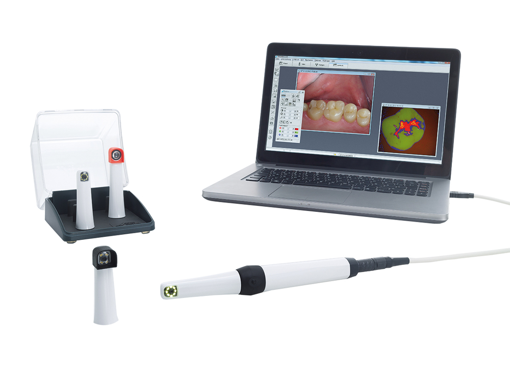 Leistungen | Dr. Serry Ihr Zahnarzt in Ravensburg